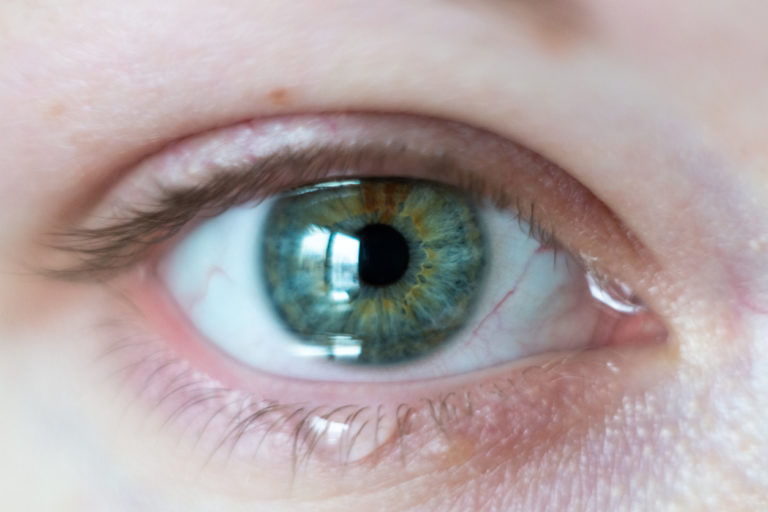 Alergia En Los Ojos Síntomas Y Tratamientos Blog De Clínica Baviera