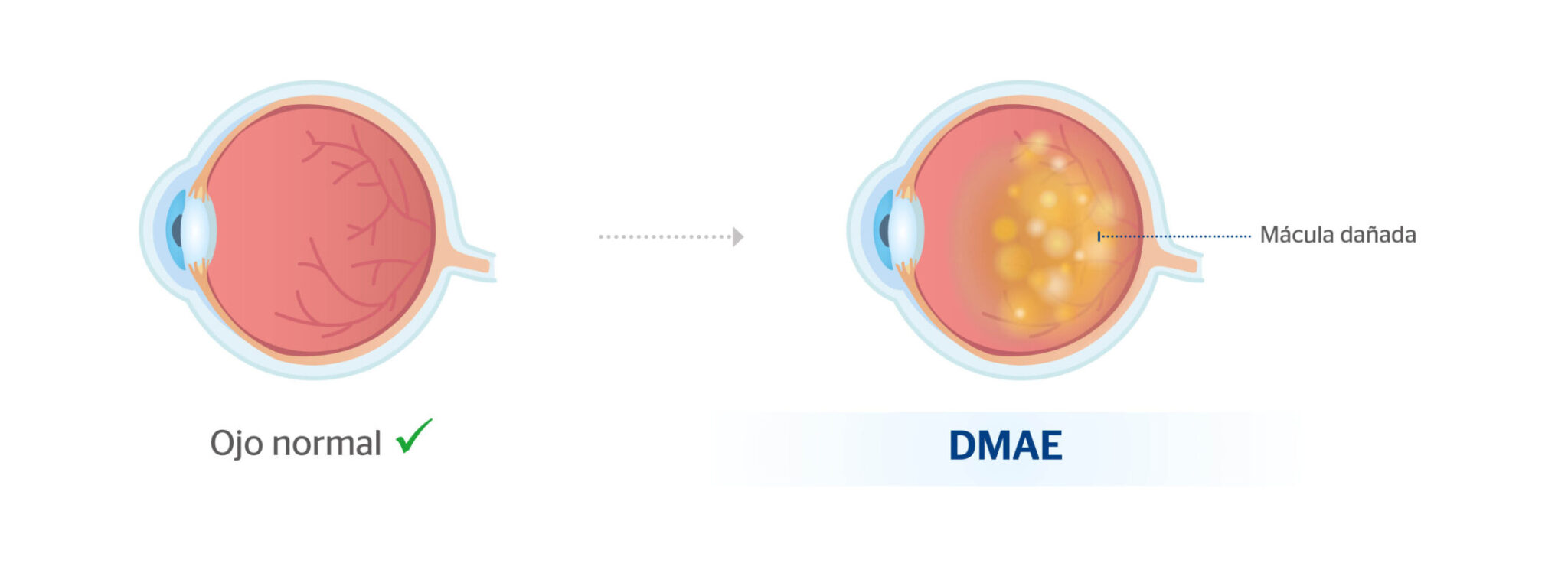 Beneficios del Omega-3 para la vista | Blog de Clínica Baviera