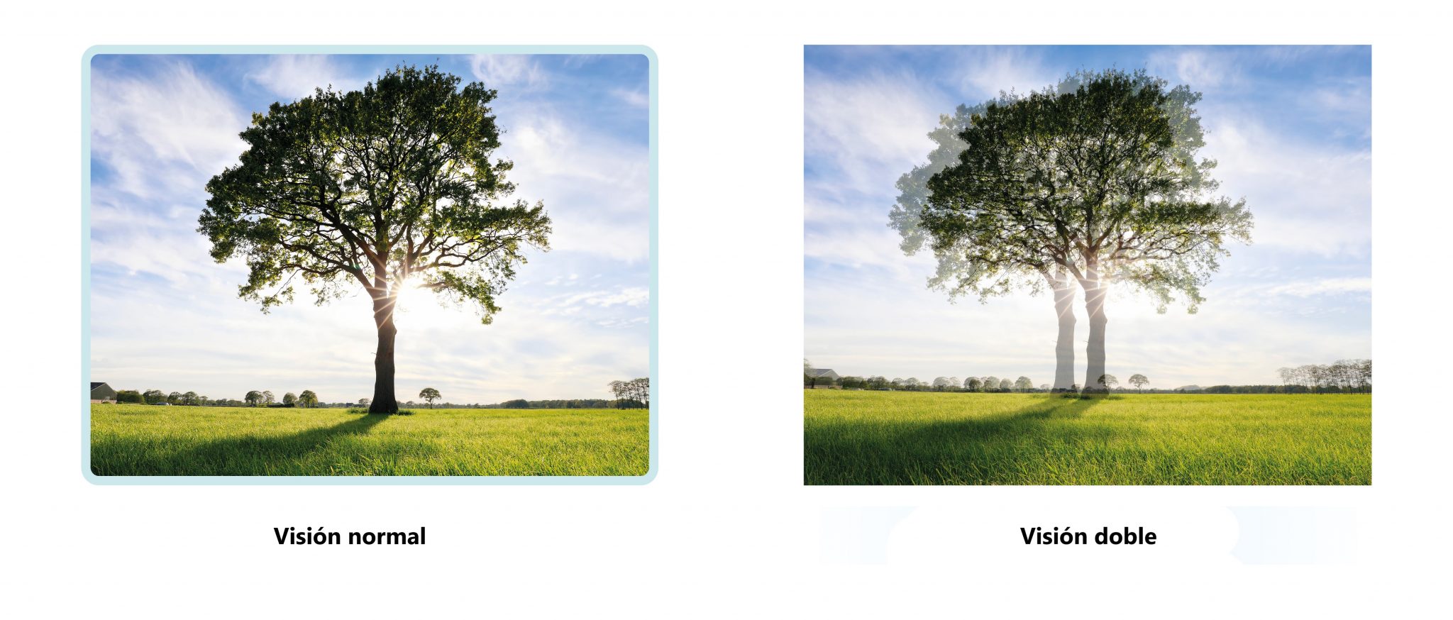 Visión doble o diplopía: causas y tratamientos | Blog de Clínica Baviera